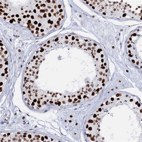Rabbit Polyclonal Anti Cmas Antibody Buy For Research Highly Specific Rigorously Validated