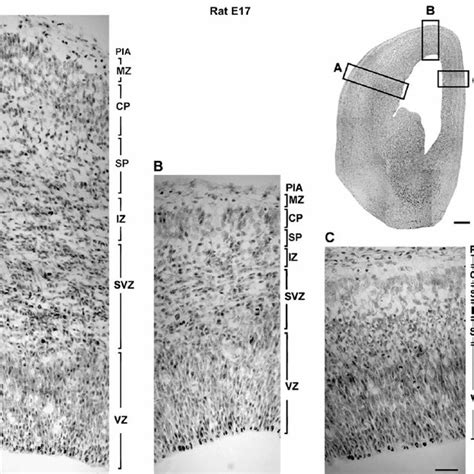 Cytoarchitecture Of Embryonic Turtle Dorsal Cortex Stage 19 S19