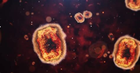 Mpox Cases In Australia Surge Past 1000