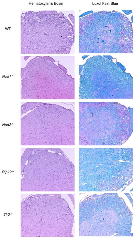 Rip2 Signaling In Central Nervous System Infiltrating Dendritic Cells Promotes Cellular