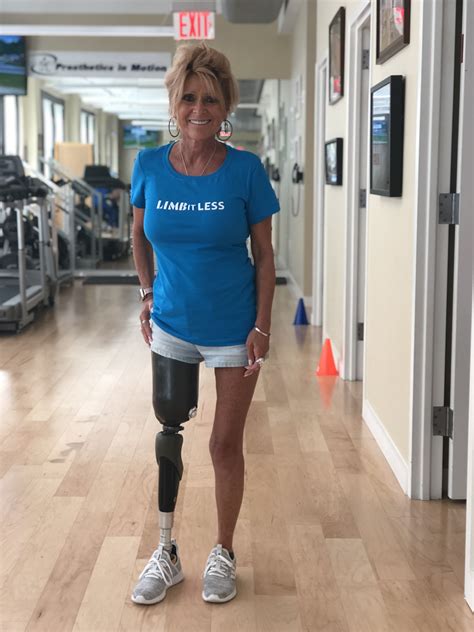 Above Knee Amputee