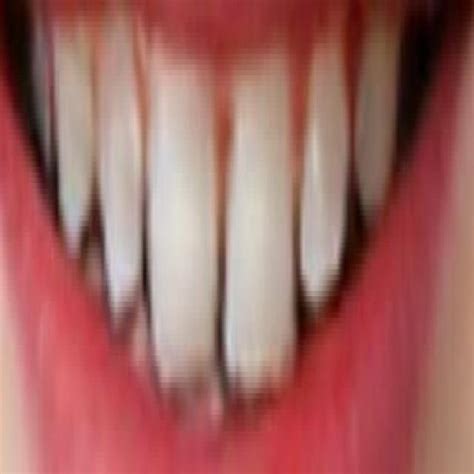 Tooth Instance Segmentation Dataset By Try