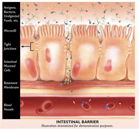 What Is Leaky Gut Syndrome Five Seasons Medical
