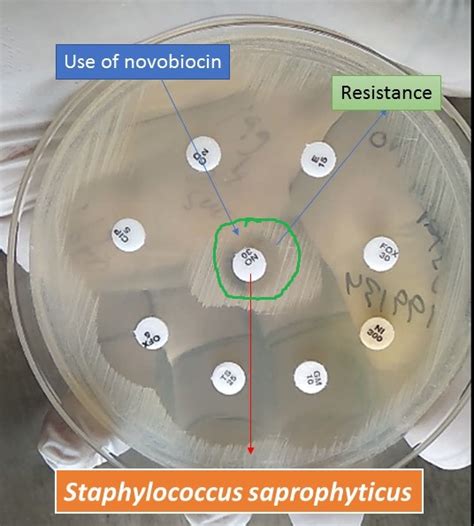 Use Of Novobiocin Disk For Presumptive Identification Of Staphylococcus