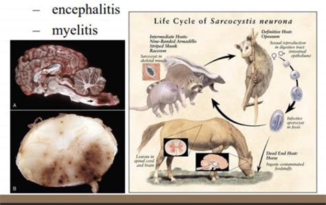 Pathology Ii Neuro Parasitic Inflammation Flashcards Quizlet