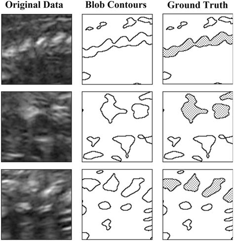 Sample Regions From Data Set And Contours Of Extracted Binary Masks