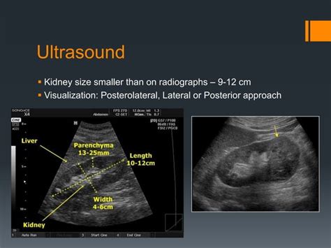 Kub Xray And Usg Ppt
