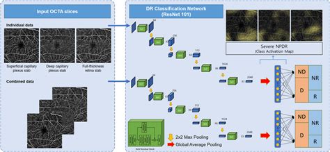 convolutional neural network based classifier for dr this end to end