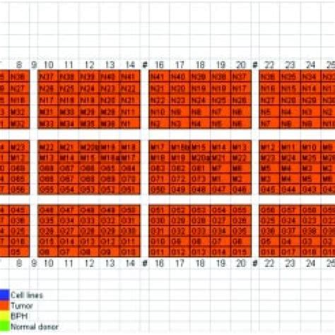 Tissue Microarray Map Bph Benign Prostatic Hyperplasia Download