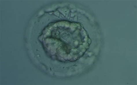Figure Collapsed Blastocyst Which Judging From The Thickness Of The ZP Is At Least A Grade