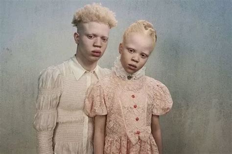 Albino Model