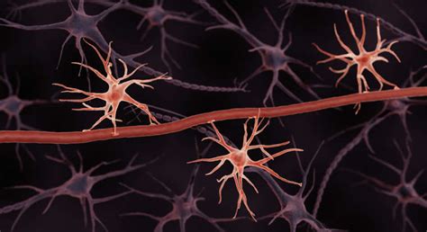 Glioblastoma The Aggressive Brain Cancer That Kills In Record Time
