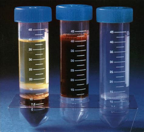 Optiprep™ Density Gradient Media Iodixanol Catalog No Axs