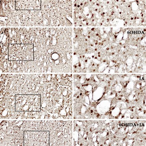 Effect Of Cortical Lesions On Darpp32 Projection Neurons In The Download Scientific Diagram