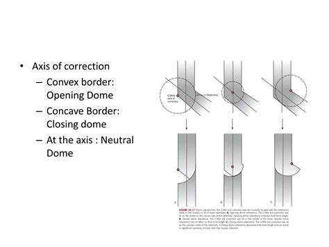 Principle Of Deformity Correction In Lower Limb Pptx