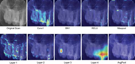 Figure 1 From Visualization Of Layers Within A Convolutional Neural Network Using Gradient