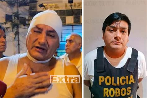 Comas Captura A Presunto Integrante De Banda Que Atacó Al Alcalde
