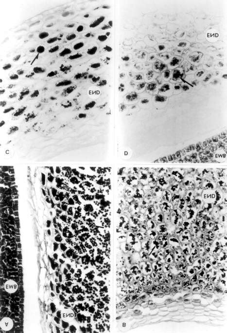 Light Micrographs Showing Protein Bodies In The Endosperm Cells Of E
