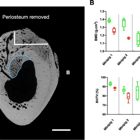 Bone Defect Healing At 2 Months A In Vivo Buccal View Of The Left Side