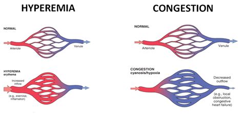 Laici Laboratório De Investigação De Câncer E Inflamação Hiperemia
