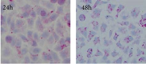 Effects Of Cell Supernatants Of 293ft Transfected With Bbxiimbbxii