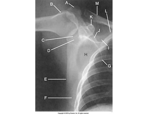 Ria Ch5 Fig 5 33 Ap Scapular Quiz