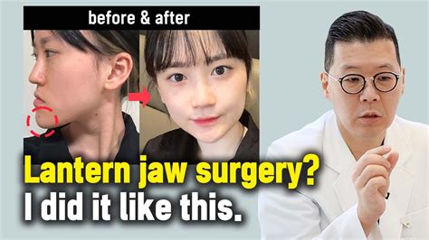 Enjp Korean Double Jaw Surgery Case Review Lantern Jaw Youtube