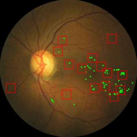 We Work On Robust And Interpretable Algorithms That Enable Machine