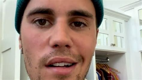 Justin Bieber Shares Paralysis Diagnosis After Getting Ramsay Hunt