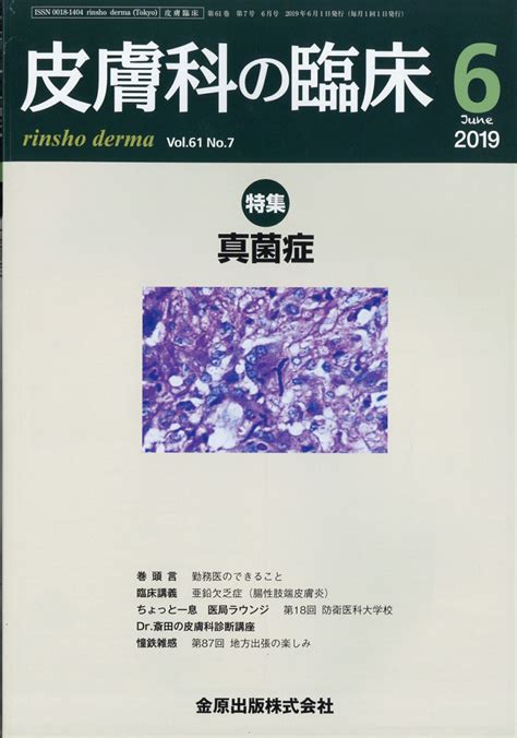 楽天ブックス 皮膚科の臨床 2019年 06月号 雑誌 金原出版 4910076370692 雑誌