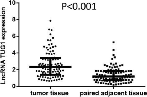 Comparison Of Lncrna Tug1 Expression In Tumor Tissue And Paired