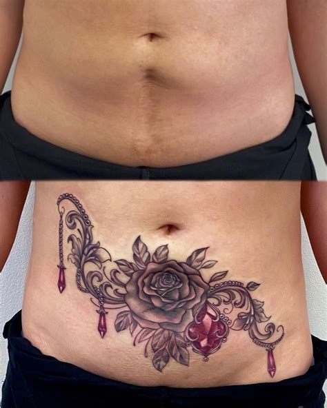 Tattoo Ideas Cover Up Tummy Tuck Scar Lise Clegg