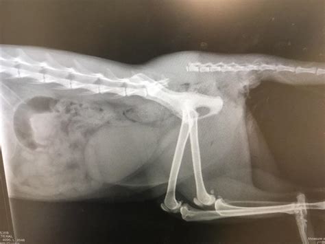 Dislocated Sacrum Dsh Approx 4 5 Years Old Ended Up Having To