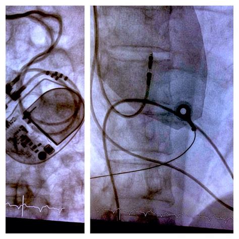Dr Nabil Paktins Journal Of Cardiovascular Medicine Blog ژورنال قلب و رگ دکتور نبــیل