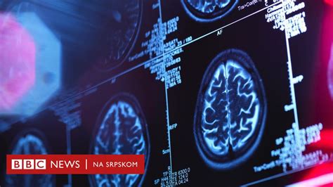 Наука Може ли вештачка интелигенција да помогне у лечењу Алцхајмерове