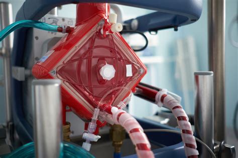Consider Starting An ECMO Program Perfusion Leaders