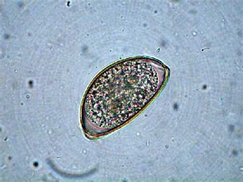 Fecal Float Parasite Pictures Gallery