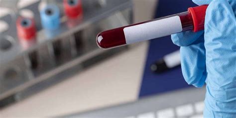 Un importante test de sangre podría detectar tipos de cánceres tempranamente Diario Con Vos
