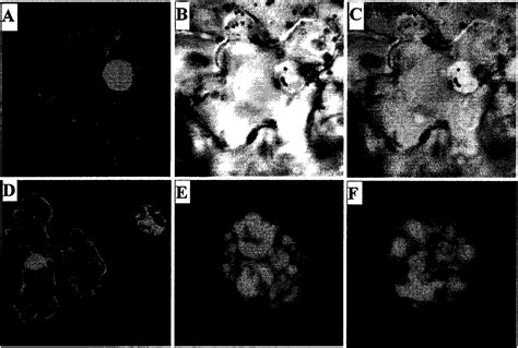 Method For Positioning And Expressing Extrinsic Proteins In Cell Nucleuses And Or Chloroplasts