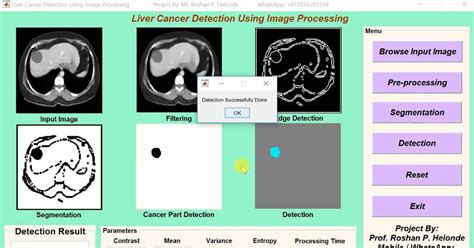 Matlab Code For Liver Cancer Detection Using Image Processing Full Project Source Code Matlab