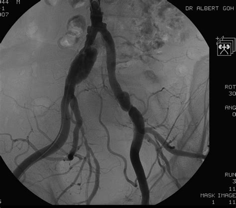 Angiogram Sydney Medical Interventions