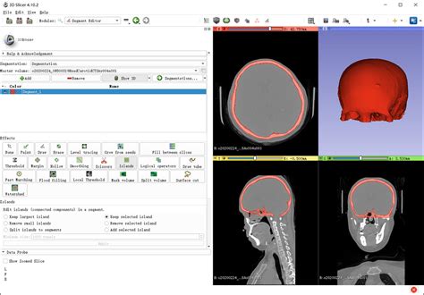 求助大佬怎么把nrrd格式导出stl格式 问题求助 3DSlicer中文论坛