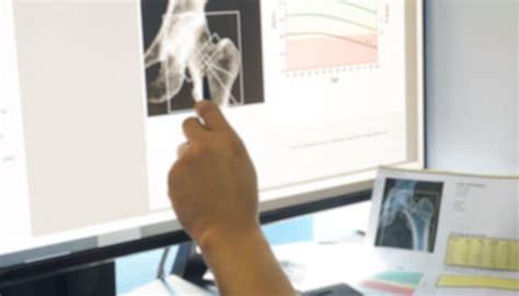 How Is A Bone Density Scan Done And How Can It Help You