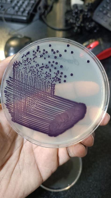 Gangesh Thayyil On Linkedin Colonies Of Chromobacterium Violaceum