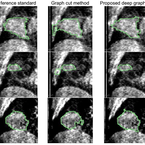 A The Hierarchical Interaction Structure Of An Image In Different Download Scientific Diagram