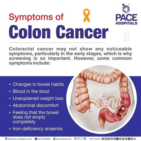 Colon Cancer Stool Shape