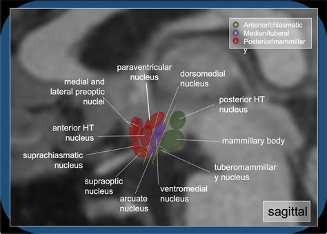 Hypothalamus Ht🧵 The Control Center Of Circadian Rhythm Fatigue