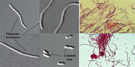 A Scanning Electron Microscope B Light Microscope ×100