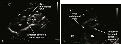 Congenital Heart Disease Clinical Gate