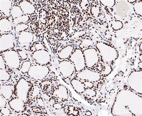 Ewsr1ews Recombinant Rabbit Monoclonal Antibody Je49 57 Et7109 94
